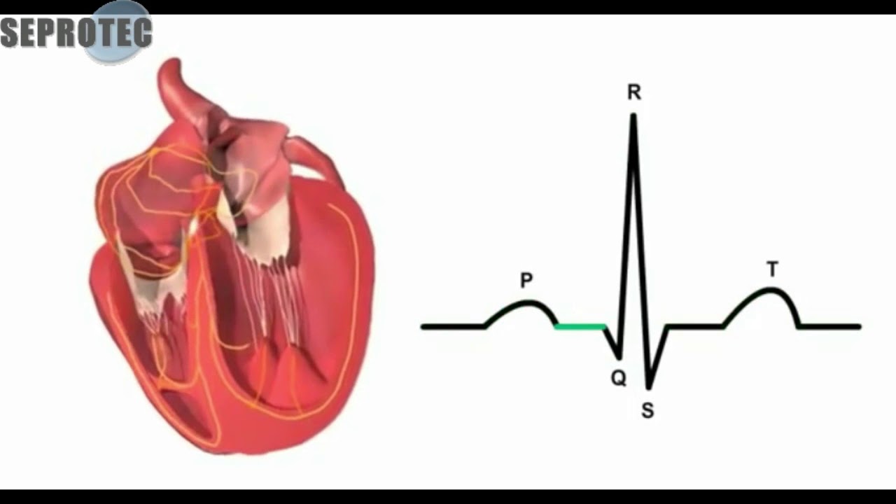 ONDAS COMPONENTES DEL ECG. - YouTube