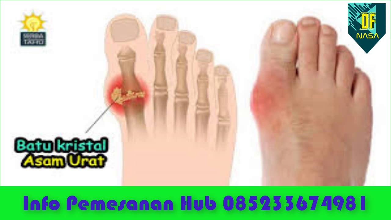 085233674981 Herbathus Nasa Atasi Pegel Linu Dan Asam Urat - YouTube