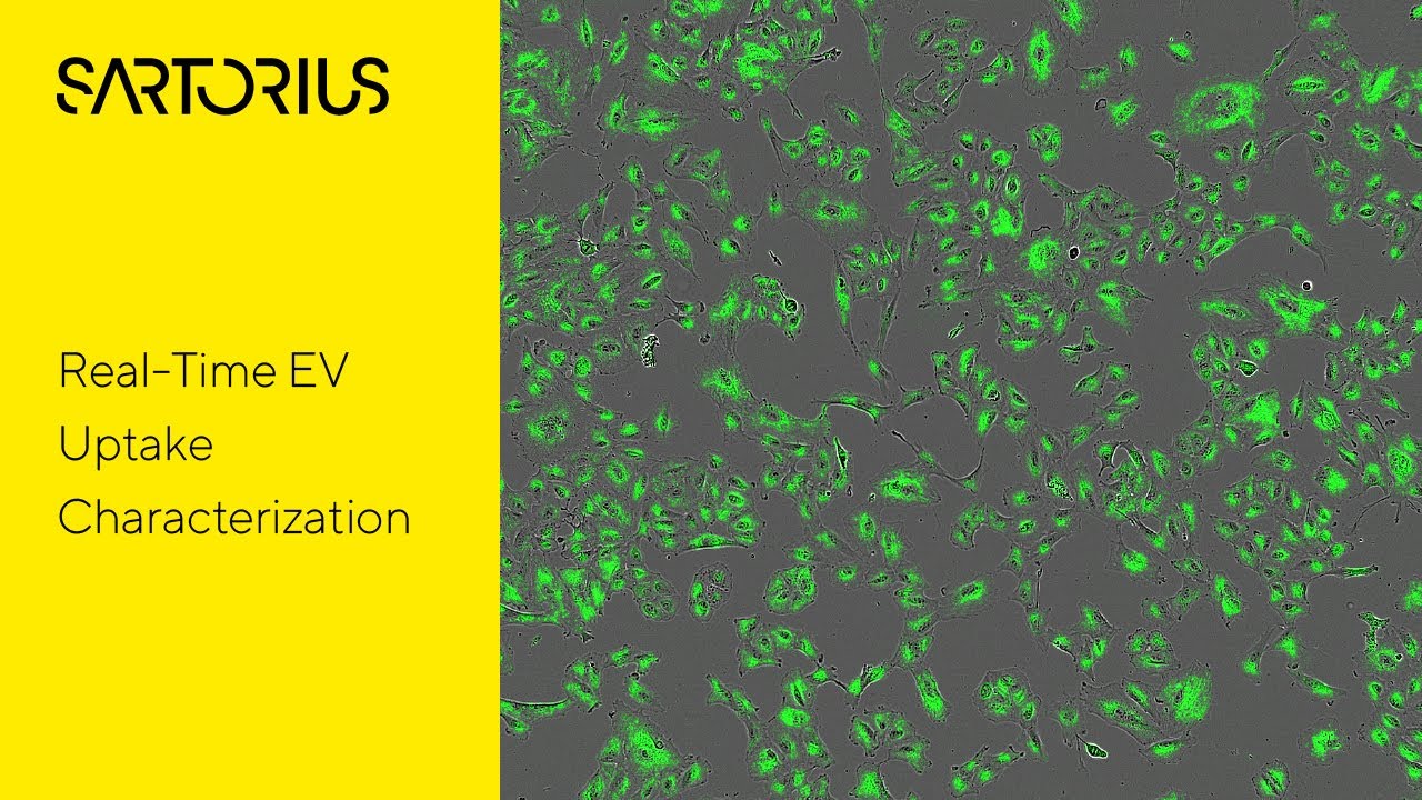 Real Time EV Uptake Characterization Using an Incucyte®️ Live Cell ...