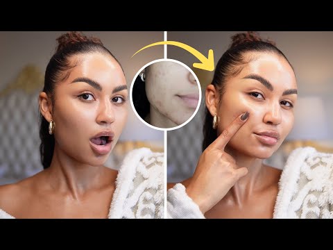 KOREAN SKINCARE: Cildimi DEĞİŞTİREN rutin