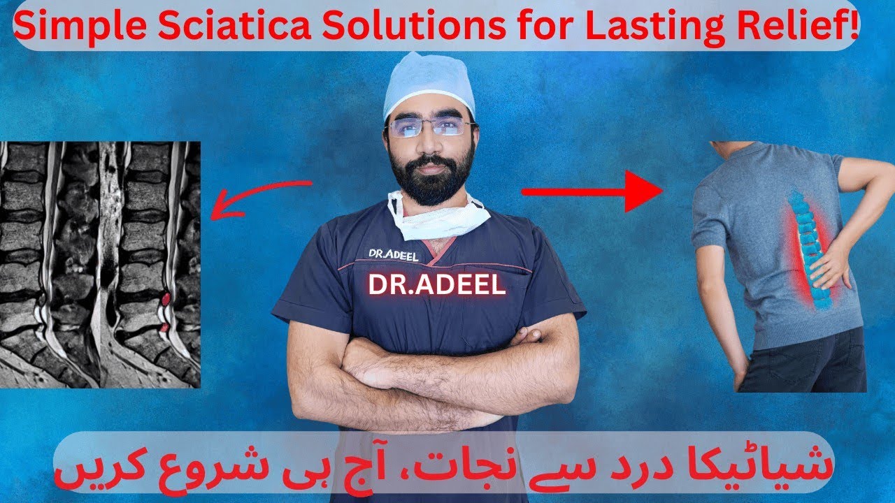 Understanding Sciatica - Causes and Relief Methods - YouTube