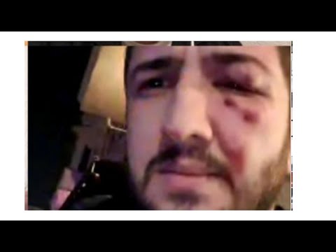 Son dəqiqə-Hakimiyyət Blogger Orxan Ağayevə sui qəsd elədi.Döyülərək tanınmaz hala saldı