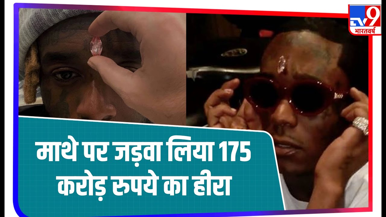 American Rapper Symere Bysil Woods ने माथे पर जड़वाया 175 करोड़ रुपये ...