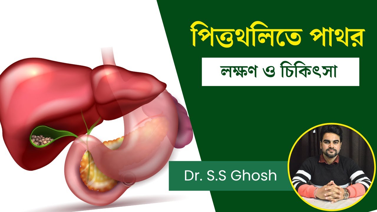 গলব্লাডারে পাথর কেন হয়? লক্ষণ ও চিকিৎসা কি? | Gallbladder Stone ...