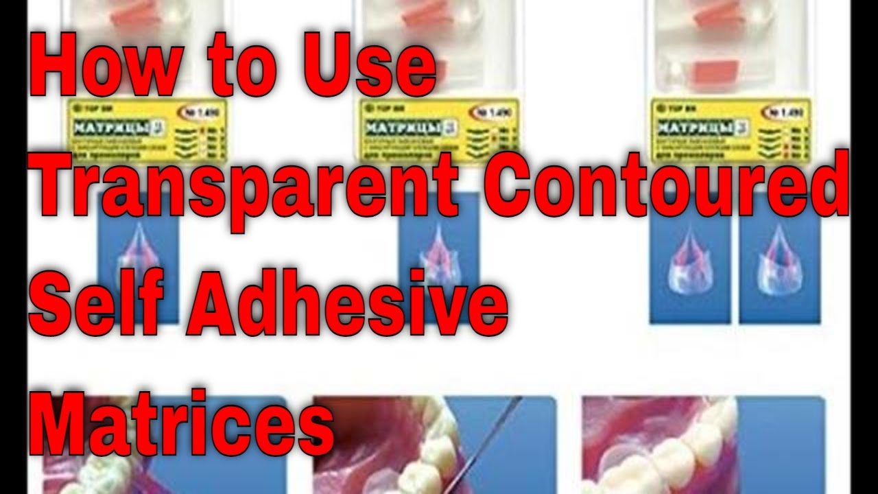 How to use Transparent Self Adhesive Matrix | Transparent Contoured ...