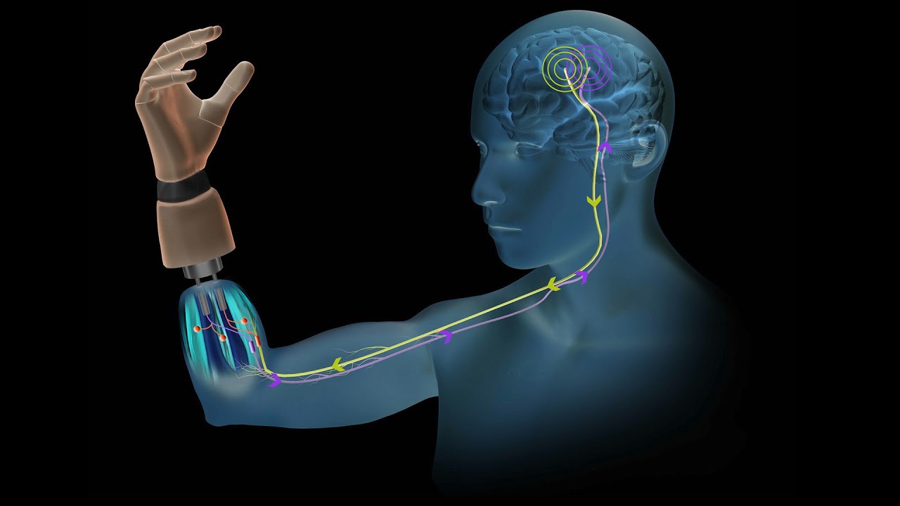 Bionic hand with neural control and feedback for use in daily life ...