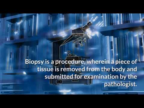 Different Types Of Biopsies - YouTube