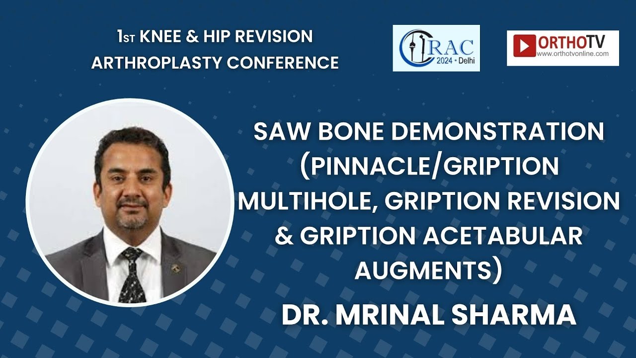 RAC 2024: Saw Bone Demo – Pinnacle, Gription Multihole, Revision ...