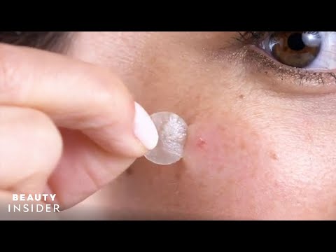 Why Mighty Patch Is The Best Acne Spot Treatment