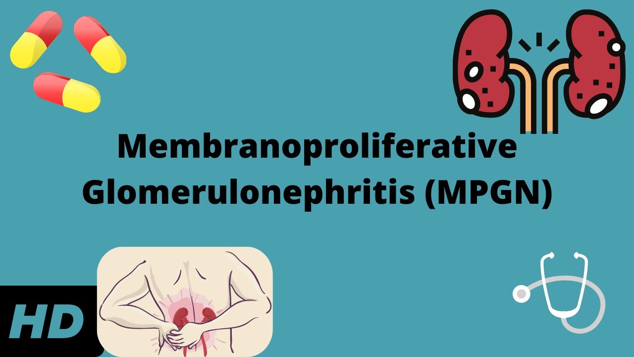 Membranoproliferative Glomerulonephritis (MPGN): Everything You Need to ...