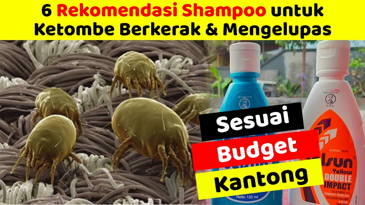 Mengalami Dermatitis Seboroik ? 6 Rekomendasi Shampoo Yang Ampuh Untuk ...