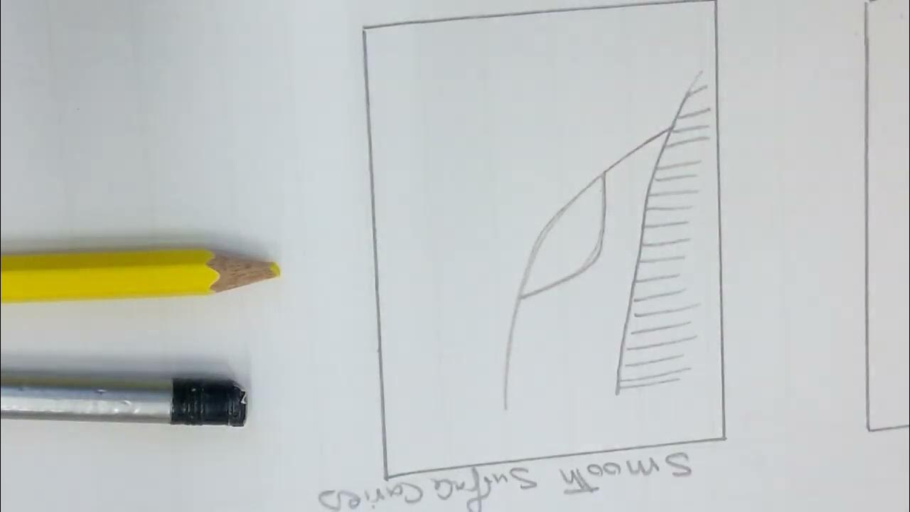 smooth surface caries drawing - YouTube