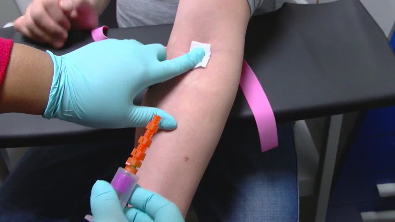 Concussion blood testing - YouTube