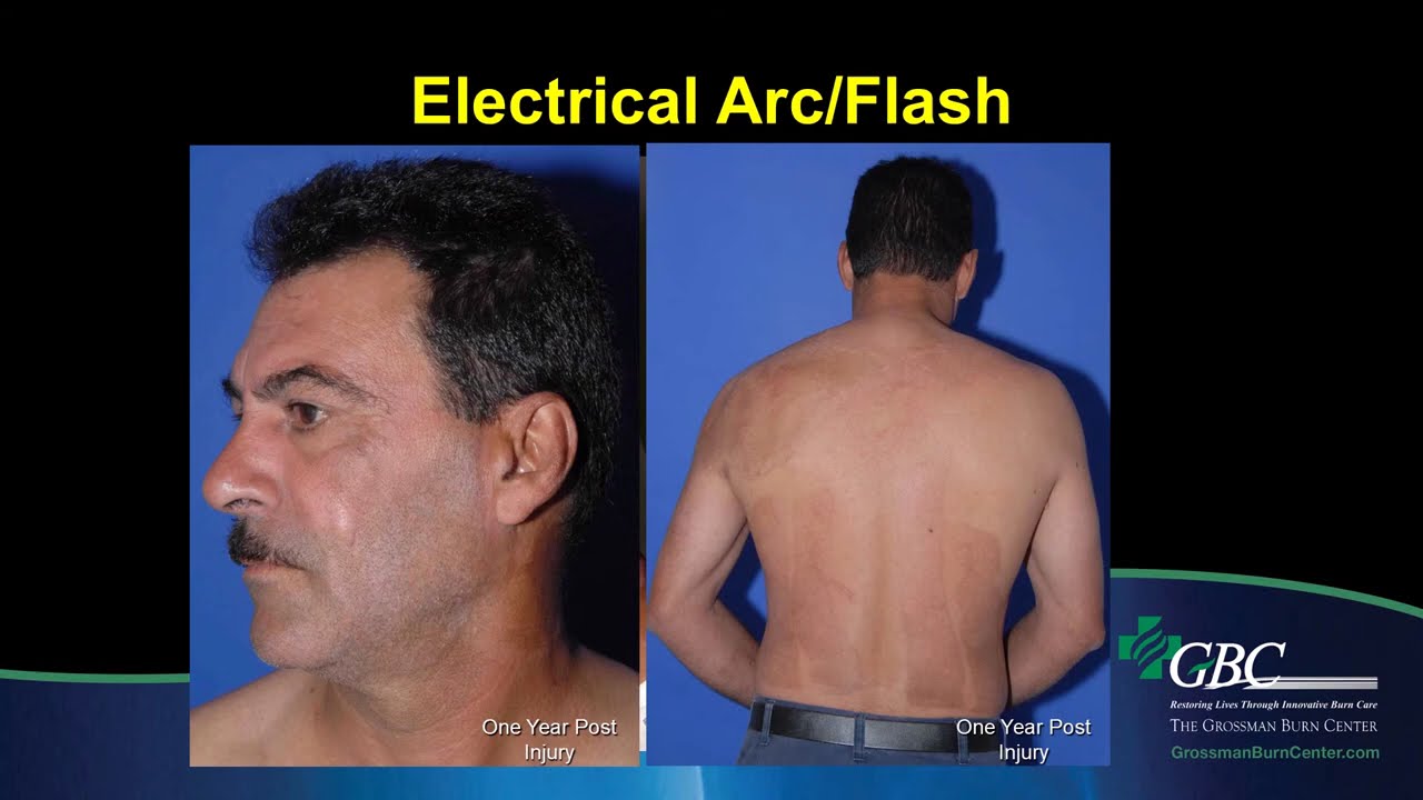 Electrical Arc/Flash Presentation 2020 - YouTube