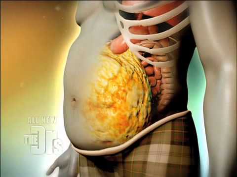 What Causes a Beer Belly Medical Course