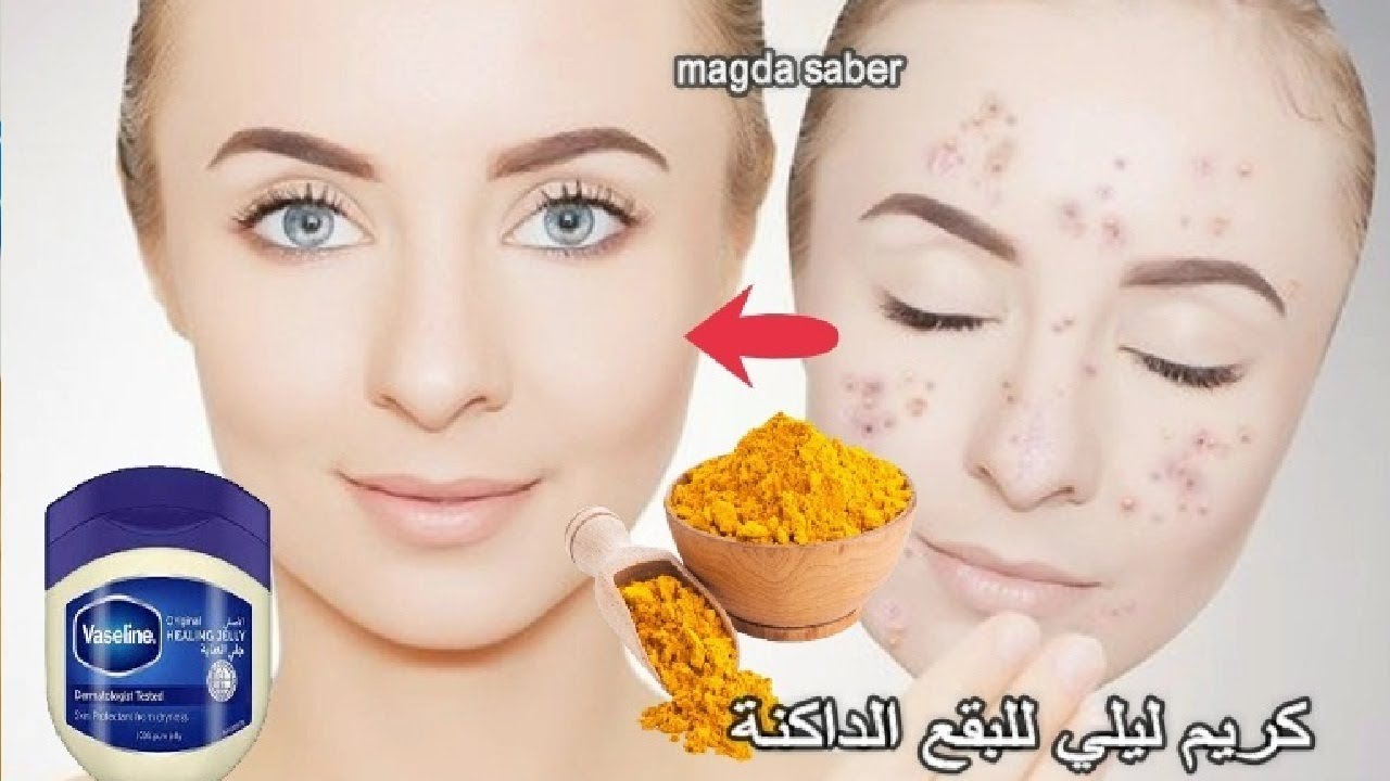 Apply Vaseline & Turmeric on Face to Remove DARK SPOTS in 3 Days - Best ...