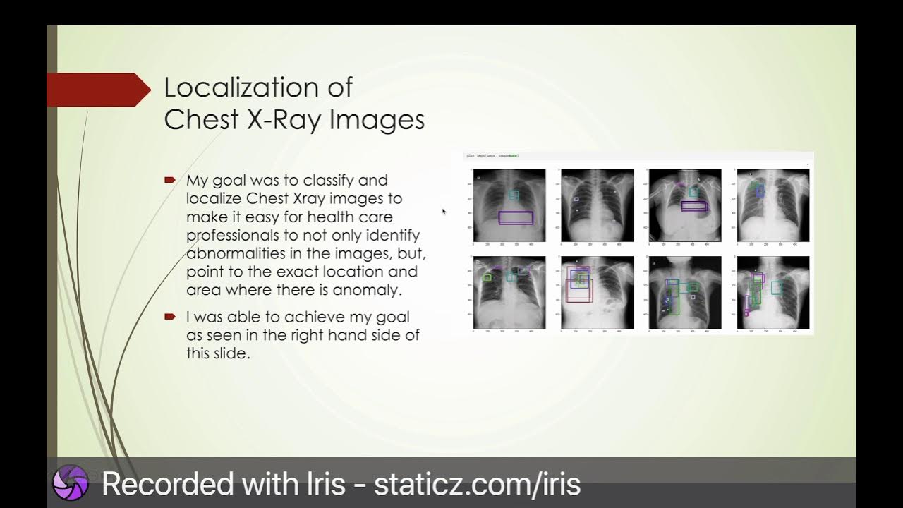 Chest X-Ray Classification and Localization using CNN(Convolution ...