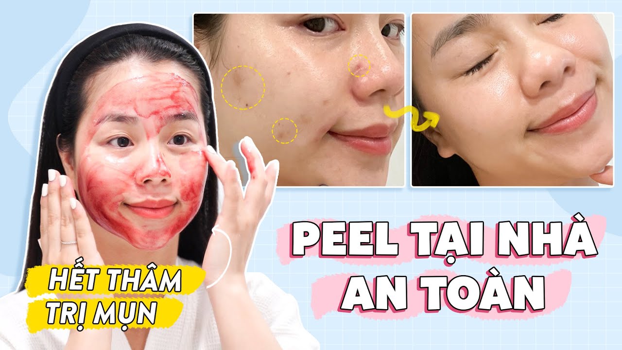 Hướng Dẫn Cách Peel Da: Quy Trình Chăm Sóc Da An Toàn và Hiệu Quả
