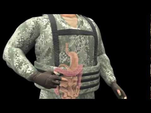 Your Brain and Blast Injuries - YouTube