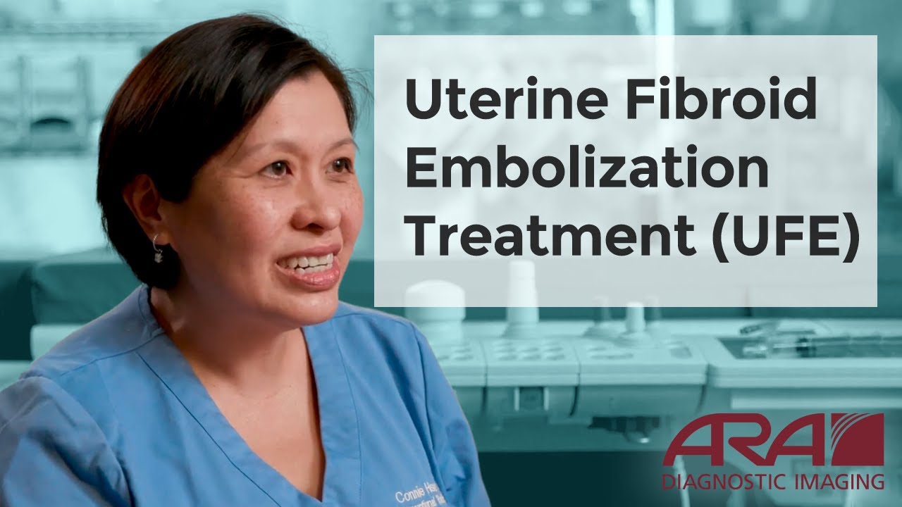 Uterine Fibroid Embolization Treatment (UFE) - ARA Diagnostic Imaging ...