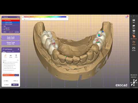#Exocad #Exoplan #3Shape #InLab #Cerec #3ShapeUnite #MillboxVHF # ...