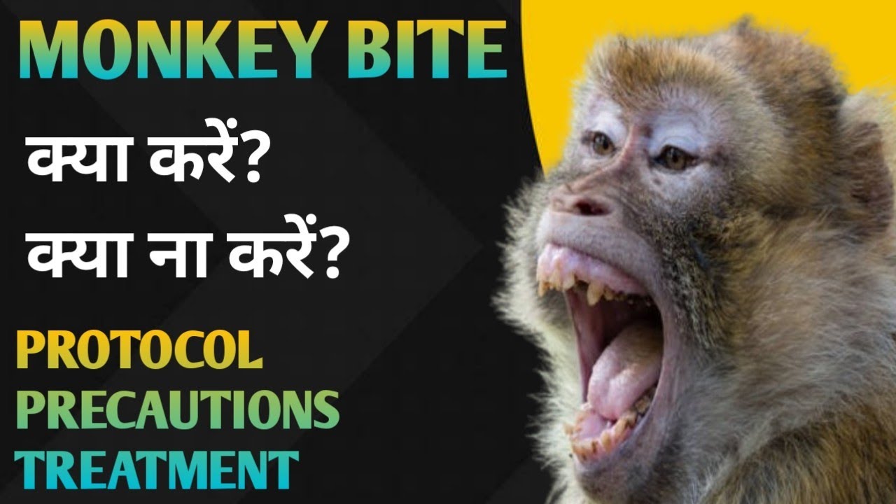 बंदर के काटने पर यह गलती ना करें । Monkey bite Treatment। Precaution and Protocol। - YouTube