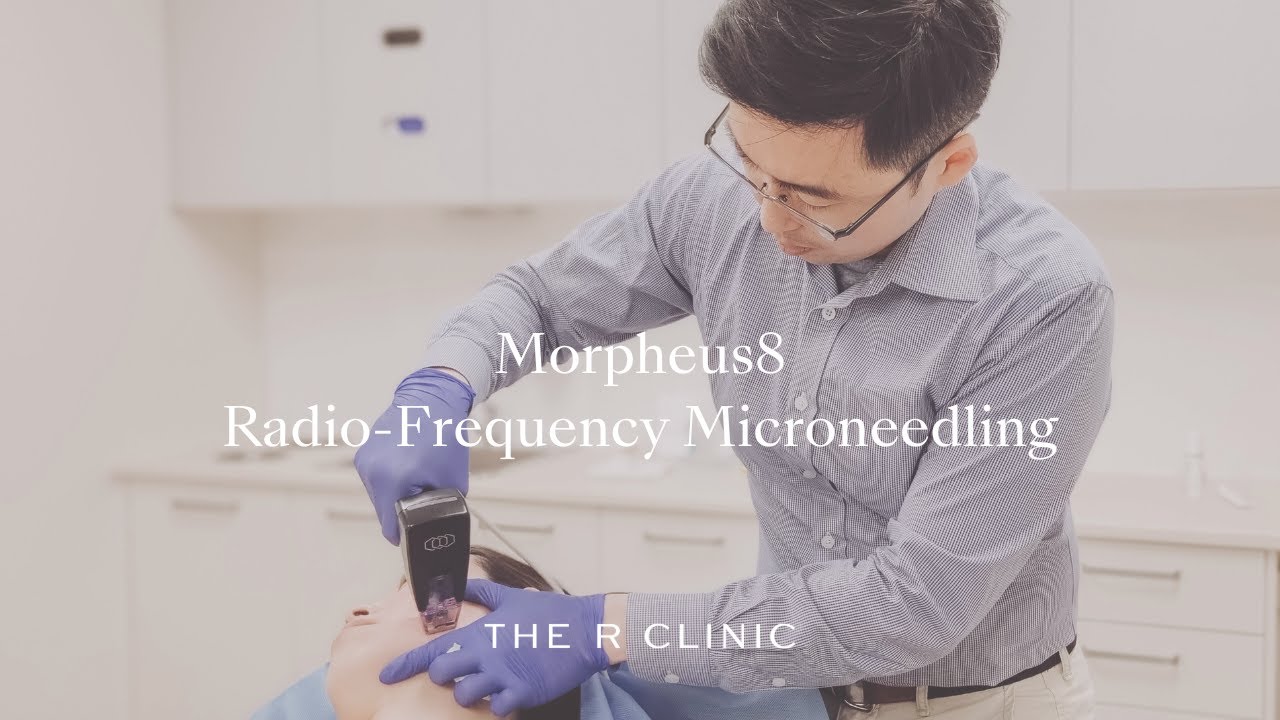 Radio-Frequency Micro-needling with Morpheus8 | THE R CLINIC - YouTube