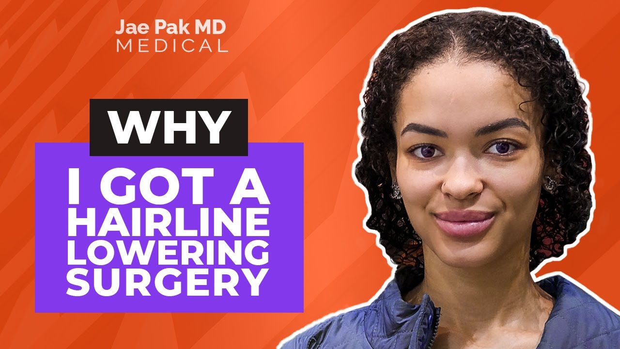 Hairline Lowering Surgery with Jae Pak MD Medical - YouTube