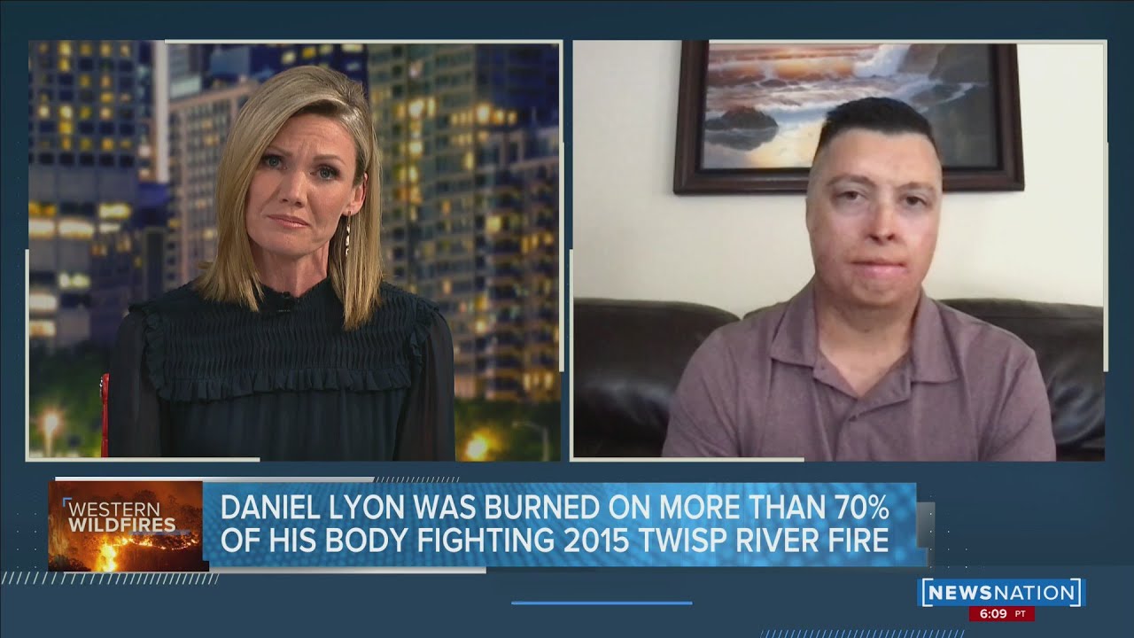 Former firefighter Daniel Lyon discusses 2015 injury fighting blaze ...