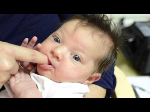 Possible Tongue and Lip Tie for Parents