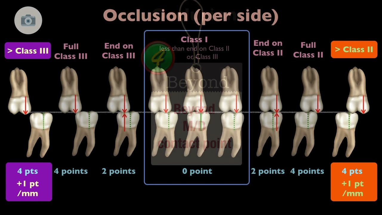 Discrepancy Index｜【Chris Chang Ortho】CC532 - YouTube