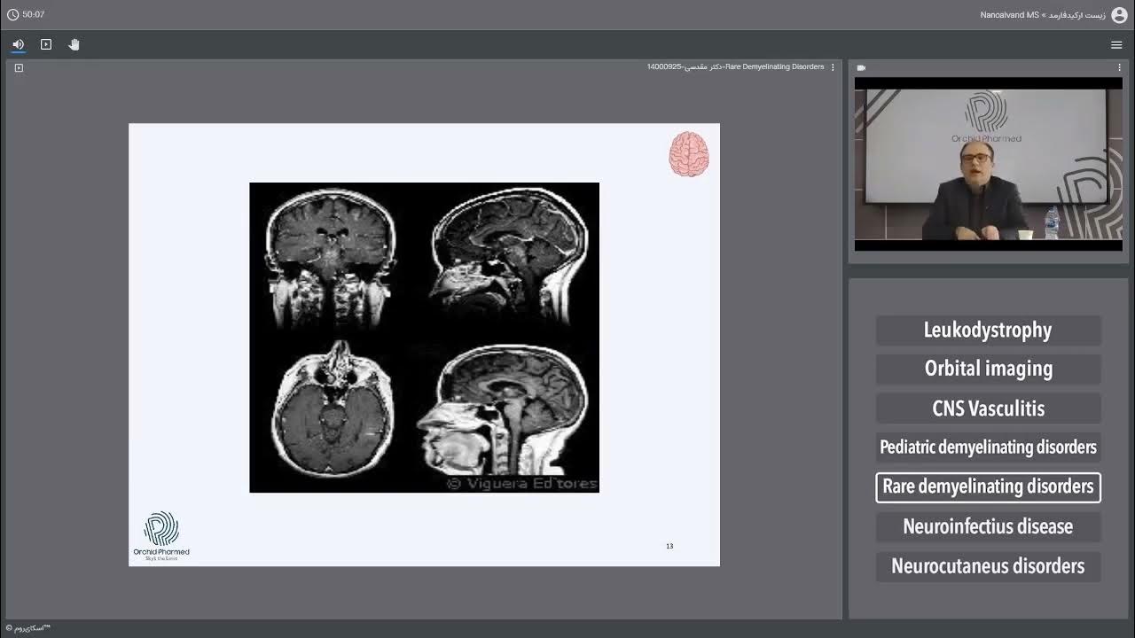 Neuroradiology course- session 5- Abdorreza Naser Moghadasi - YouTube