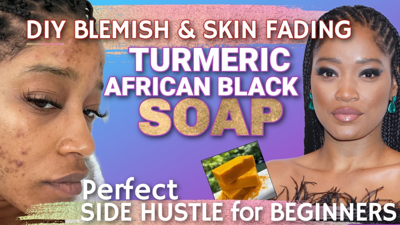 DIY - Fade Dark spots and Start that Side Hustle - YouTube