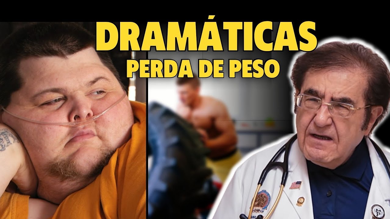 6 TRASFORMA ES MAIS DR STICAS EM QUILOS MORTAIS ANTES E DEPOIS YouTube 6-trasforma-es-mais-dr-sticas-em-quilos-mortais-antes-e-depois-youtube