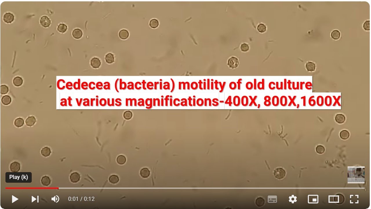 Cedecea motility of old culture at various magnifications - YouTube