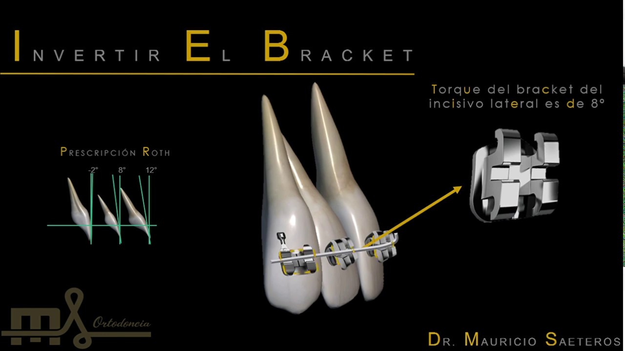 OPCIONES DE TORQUE NEGATIVO - YouTube