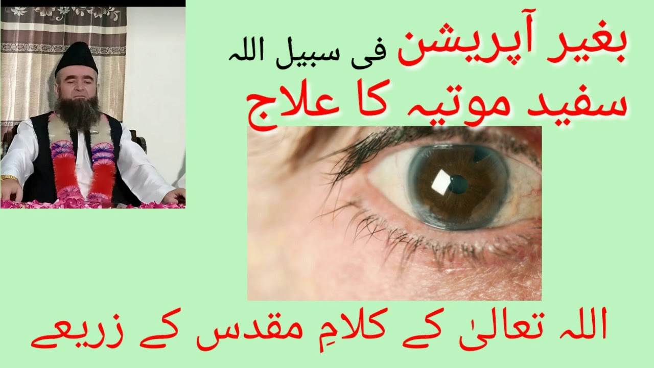 Safaid Motiya ka Ilaj baghair Operation - YouTube