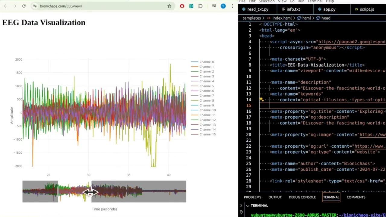 EEG Data Visualization with Flask & Plotly: Real-Time Analysis, Ethics, and Seizure Detection ...