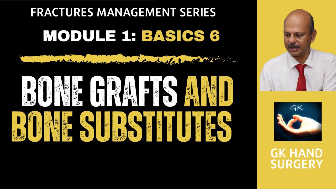Hand Fractures: Basics 6 - Bone grafts and Bone substitutes ...
