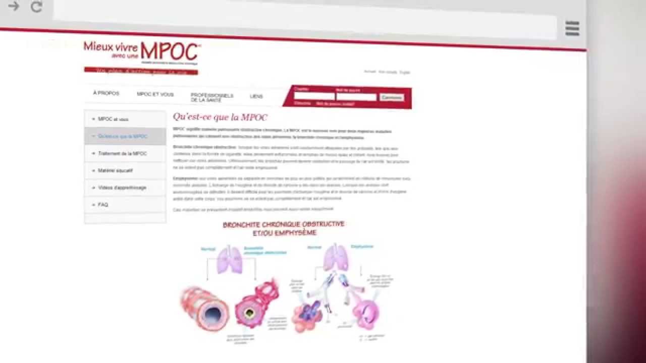 Mieux Vivre avec une MPOC - YouTube