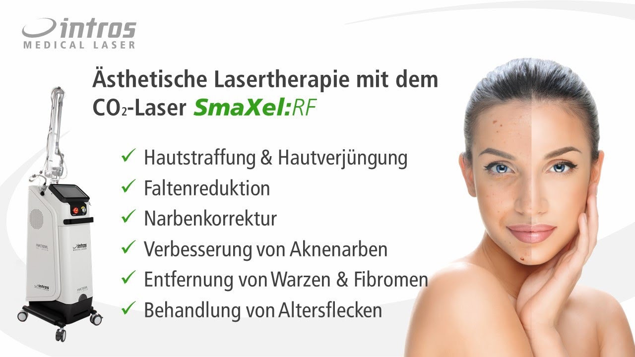 Produktvideo Smaxel RF - YouTube