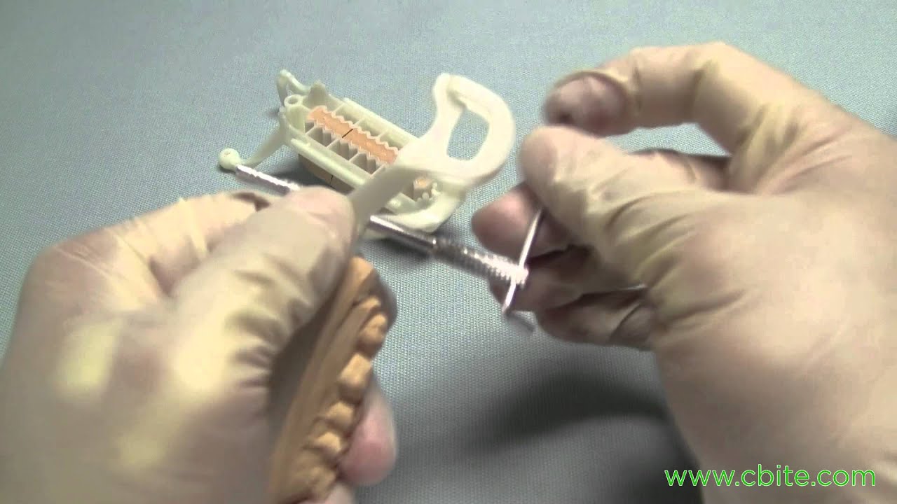 Articulator - Cbite Falcon™ Backstop or Incisal Pin Use - YouTube