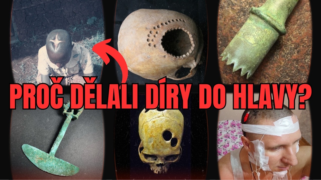 Nejstarší OPERACE na světě, která ŠOKUJE i dnes | Historie trepanace ...