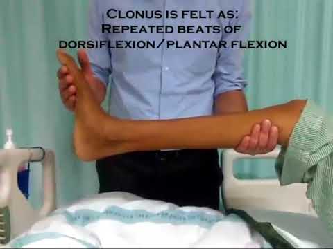 Eliciting ankle clonus - YouTube