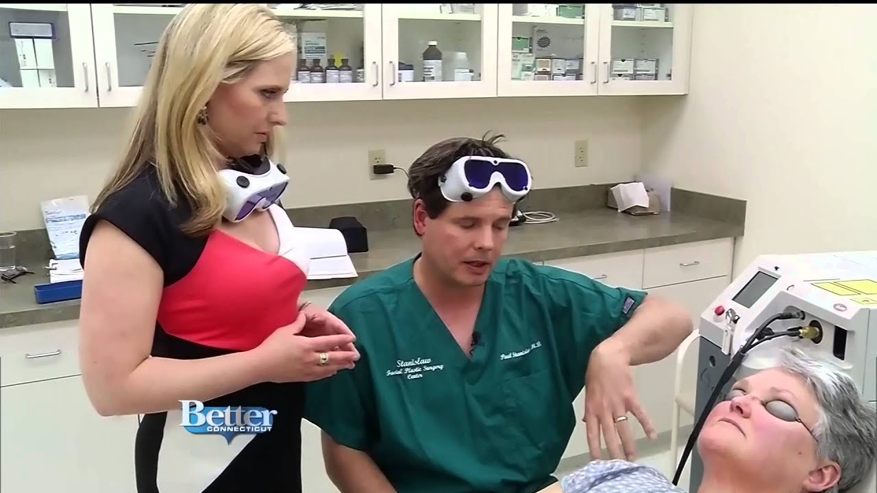 Pulse Dye Laser Treatment: Facial Redness Removal - YouTube