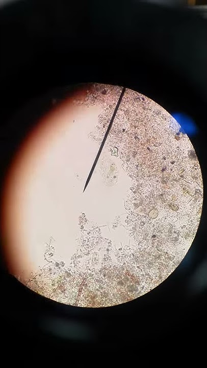 Pond water under microscope - YouTube