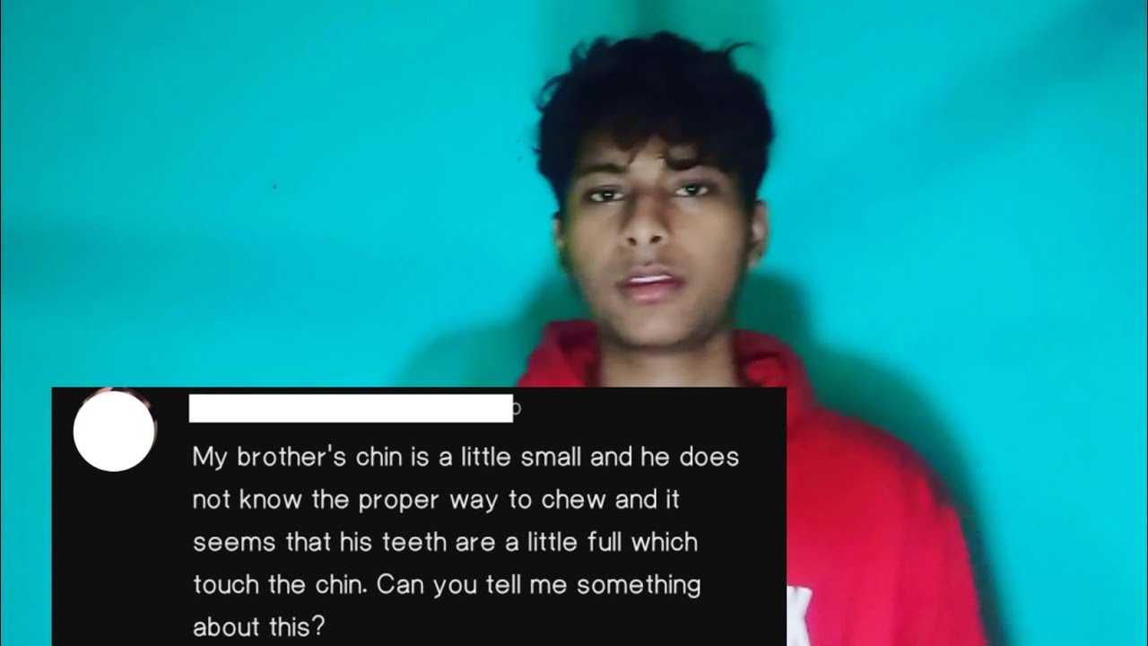 How to solve receding chin problem. - YouTube