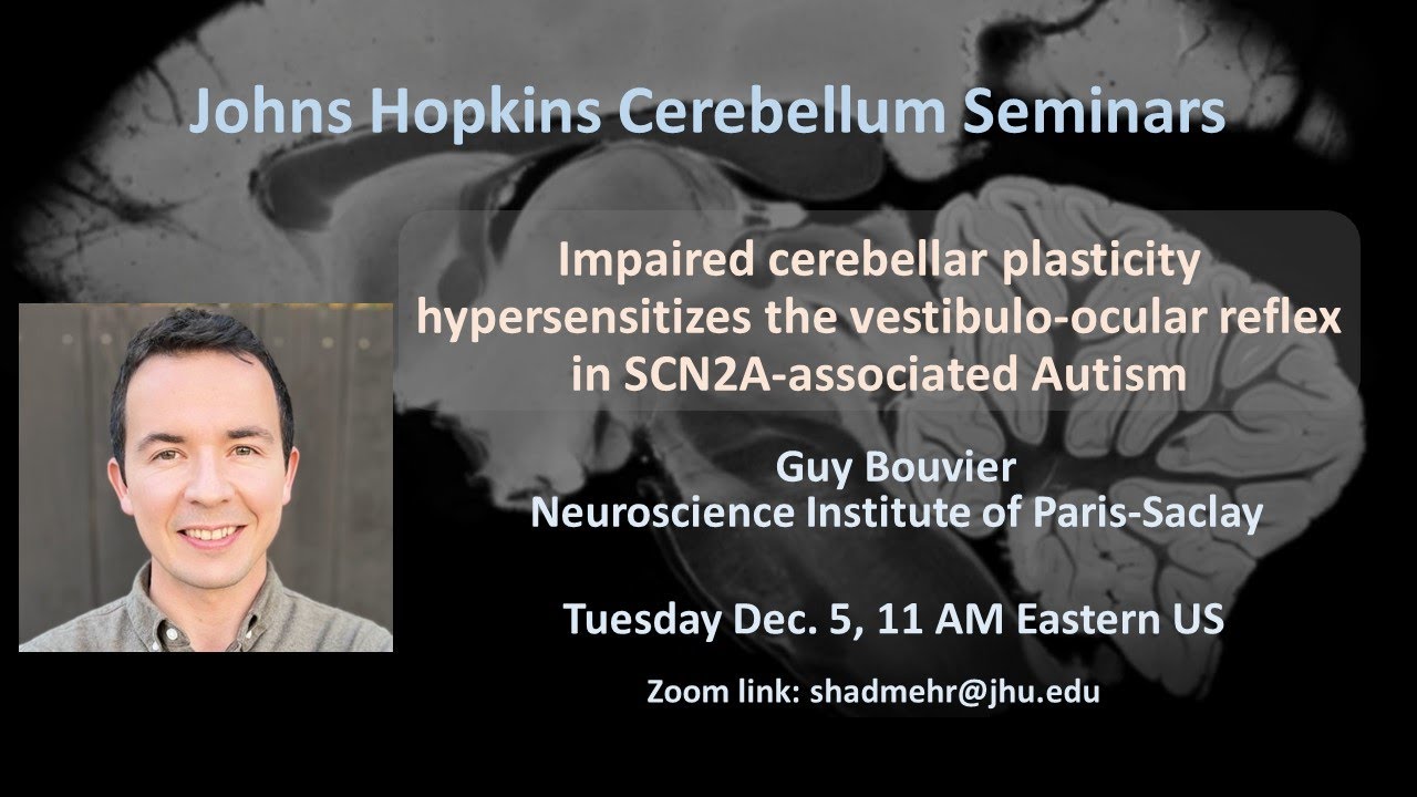 Guy Bouvier: Impaired cerebellar plasticity hypersensitizes the VOR in ...