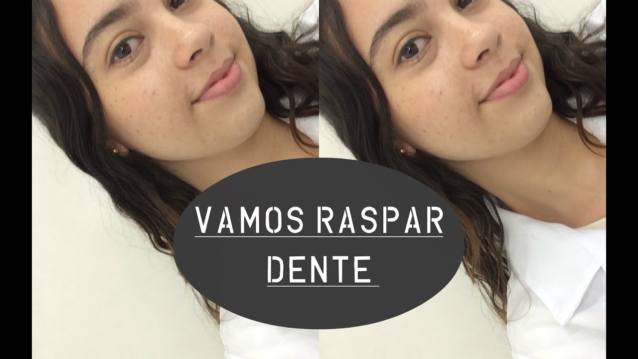 Vlog ODONTO - Raspando dente / Confecção da lamina ♧ - YouTube