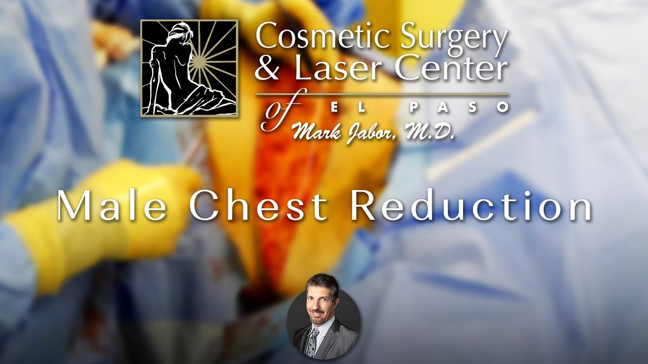 Male Chest Reduction. - YouTube